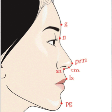 Effects of facial projection and recession on front view + masculinity ...